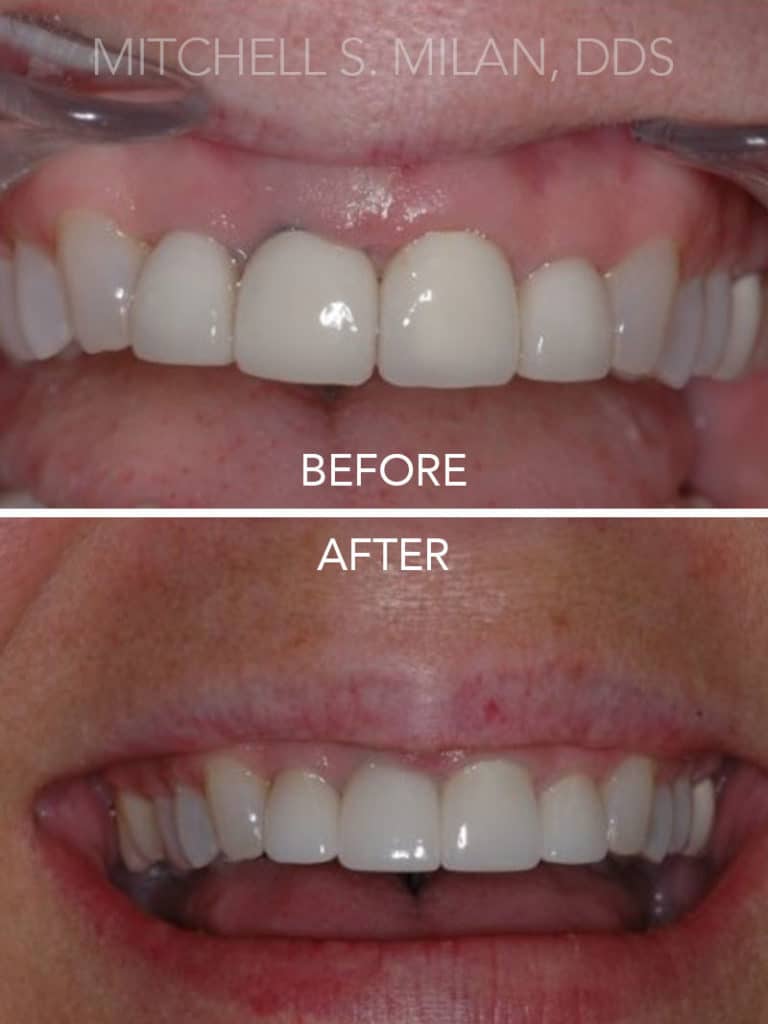 Dr. Milan’s Dental Artistry - Birmingham Center for Cosmetic Dentistry