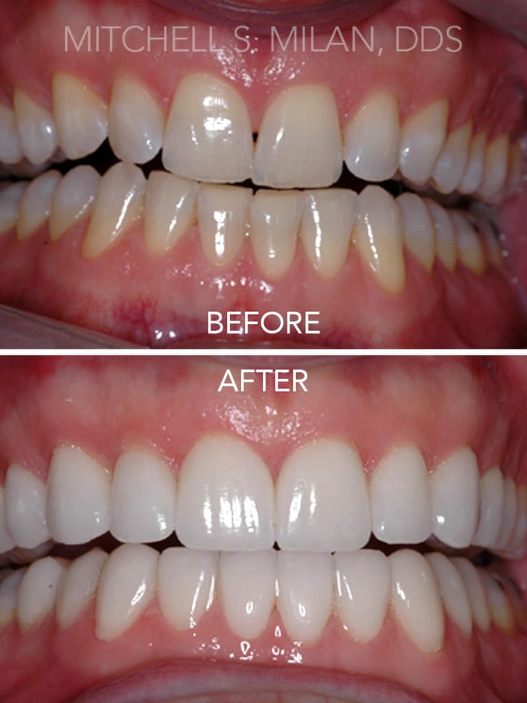 Dr. Milan’s Dental Artistry - Birmingham Center for Cosmetic Dentistry