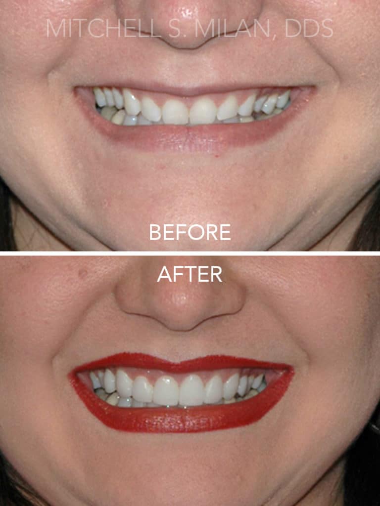 Dr. Milan’s Dental Artistry - Birmingham Center for Cosmetic Dentistry